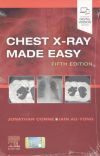 CHEST X-RAY MADE EASY - JONATHAN CORNE - 9780702082344