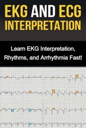 EKG AND ECG INTERPRETATION - ALYSSA STONE - 9781761031038