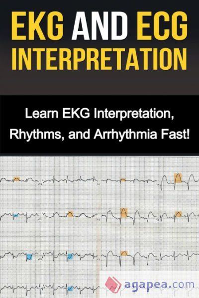 EKG AND ECG INTERPRETATION - ALYSSA STONE - 9781761031038