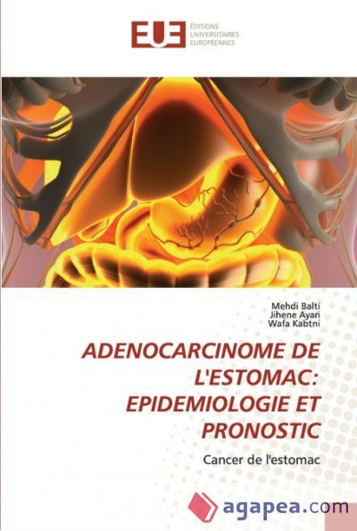 ADENOCARCINOME DE LA ESTOMAC - JIHENE AYARI,MEHDI BALTI,WAFA KABTNI ...