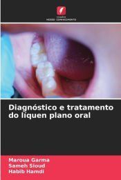 DIAGNOSTICO E TRATAMENTO DO LIQUEN PLANO ORAL - HABIB HAMDI,MAROUA GARMA,SAMEH SIOUD - 9786208259822