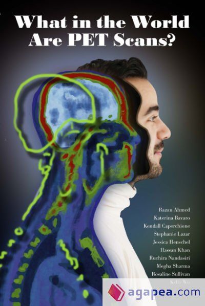 WHAT IN THE WORLD ARE PET SCANS? - AUSTIN MARDON,KATERINA BAVARO,RAZAN ...
