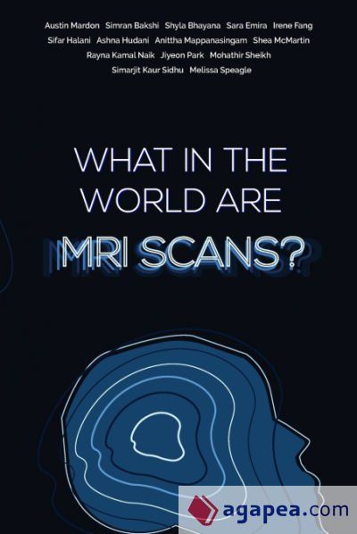 WHAT IN THE WORLD ARE MRI SCANS? - AUSTIN MARDON,SHYLA BHAYANA,SIMRAN ...