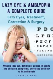 LAZY EYE & AMBLYOPIA. LAZY EYES, TREATMENT, CORRECTION AND SURGERY ...