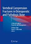 VERTEBRAL COMPRESSION FRACTURES IN OSTEOPOROTIC AND PATHOLOGIC BONE ...